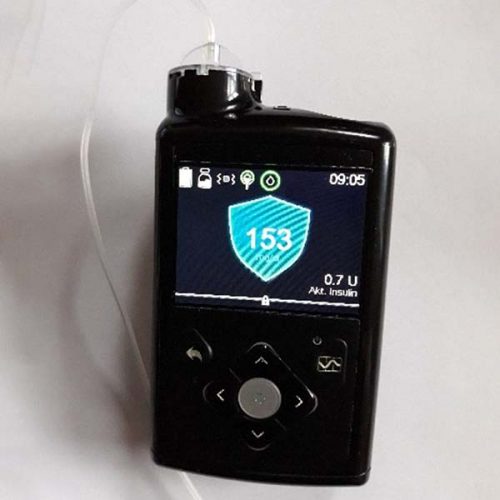 Medtronic MiniMed 670G Insulinpumpensystem - Schwerpunktpraxis Diabetes ...